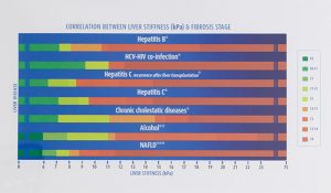 FIBROSCAN® 502 TOUCH